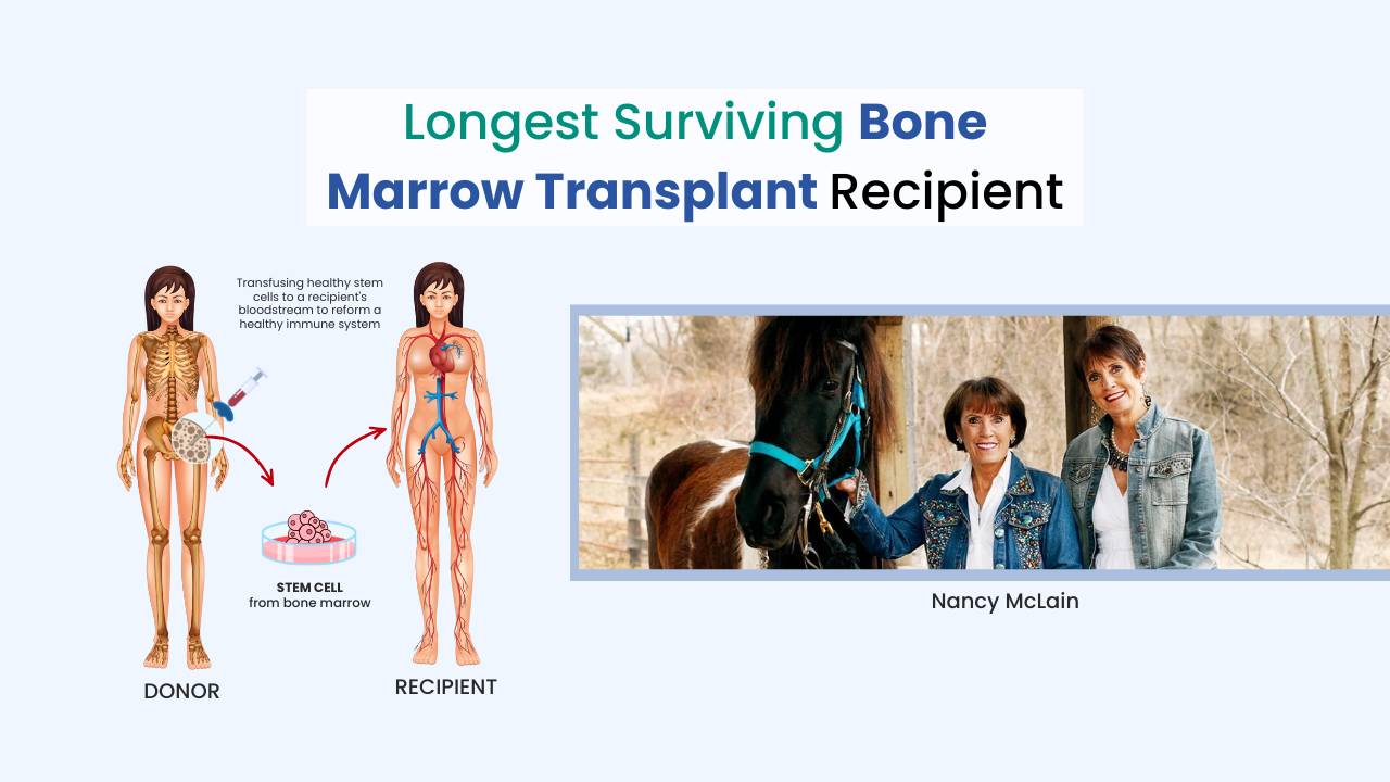 Longest Bone Marrow Transplant Survival Case