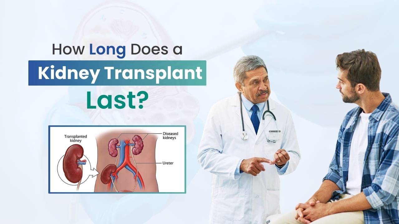 How Long Does a Kidney Transplant Last? Lifespan & Key Factors