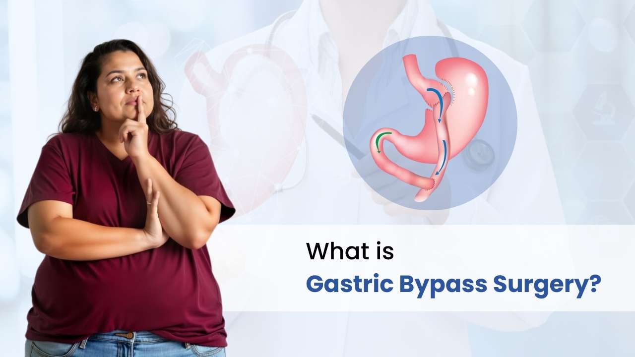 Gastric Bypass Scars: What to expect and How to Fade them