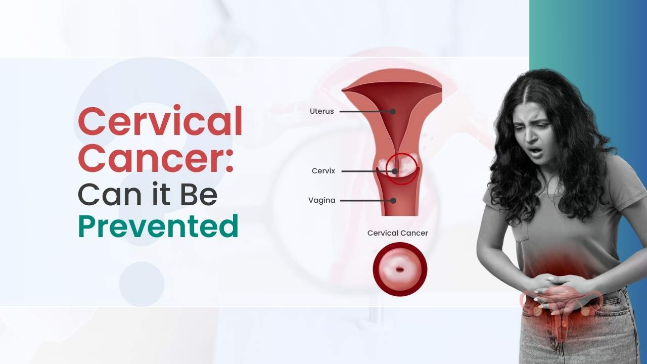 Cervical Cancer: Risk, Prevention and Treatment Guide