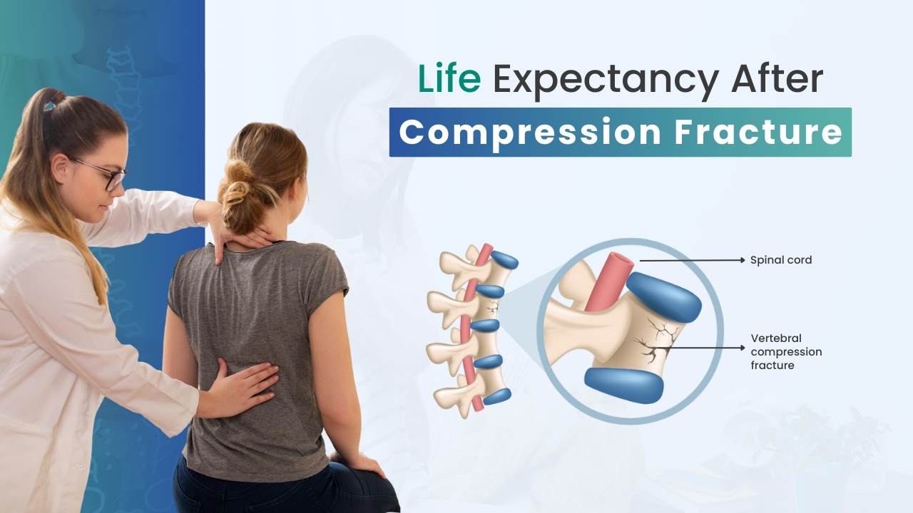 Life Expectancy After Compression Fracture | Symptoms and Treatment