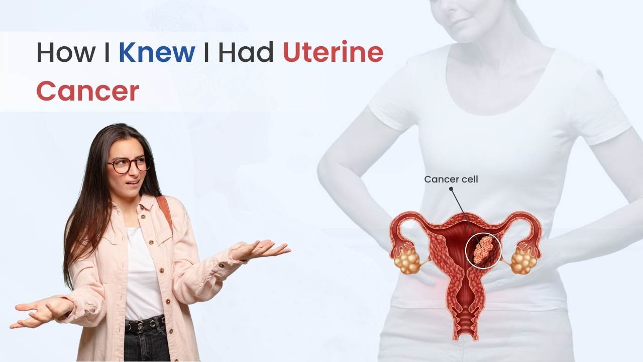 How I know i Had Uterine cancer | Cause, Option, Prevention