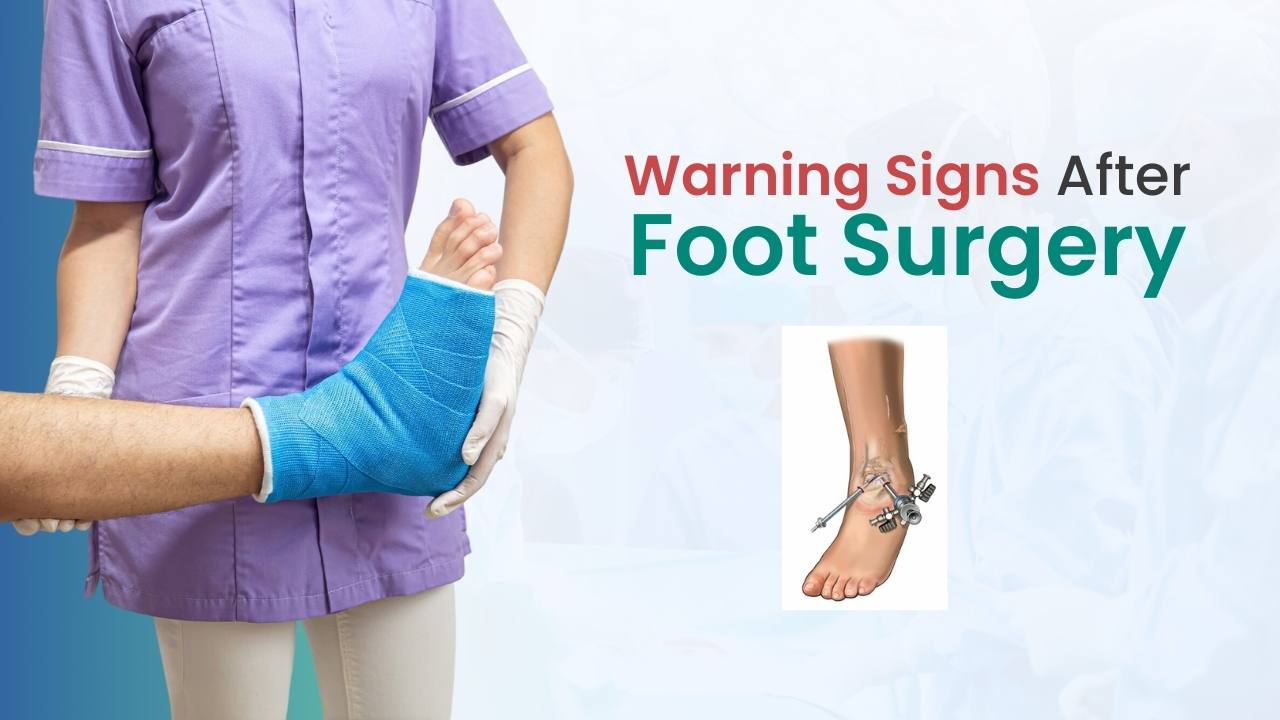 After Foot Surgery | Common Warning Sign and Complication